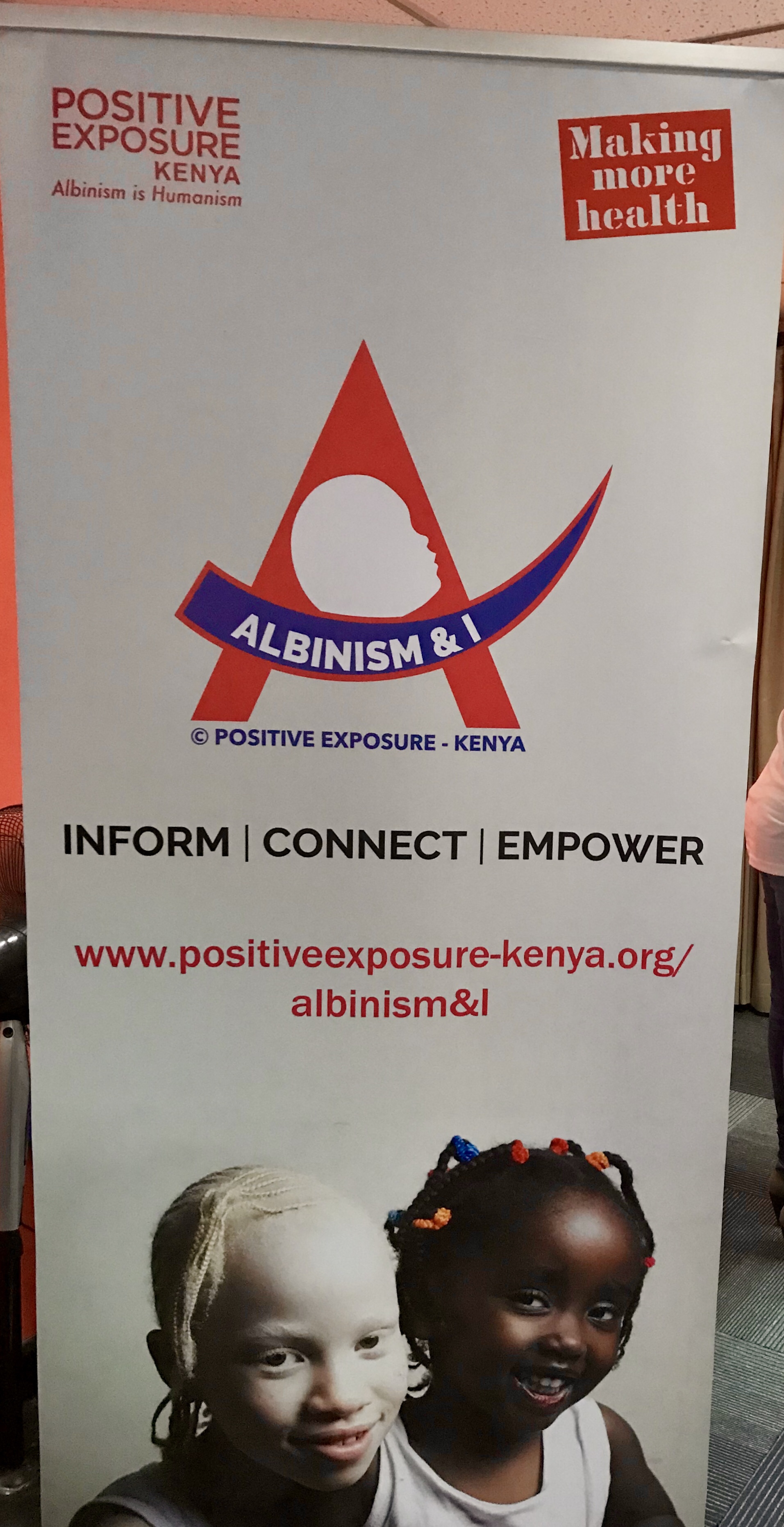 Better life for people with albinism – human rights, community, health ...