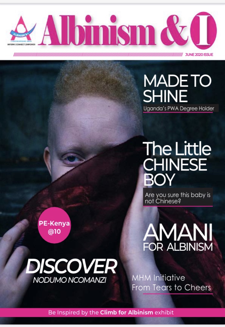 The 1st edition of the Albinism magazine is live and Making More Health ...