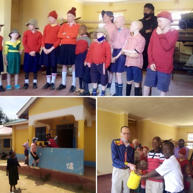 More schools get involved in our awareness programs about albinism and ...
